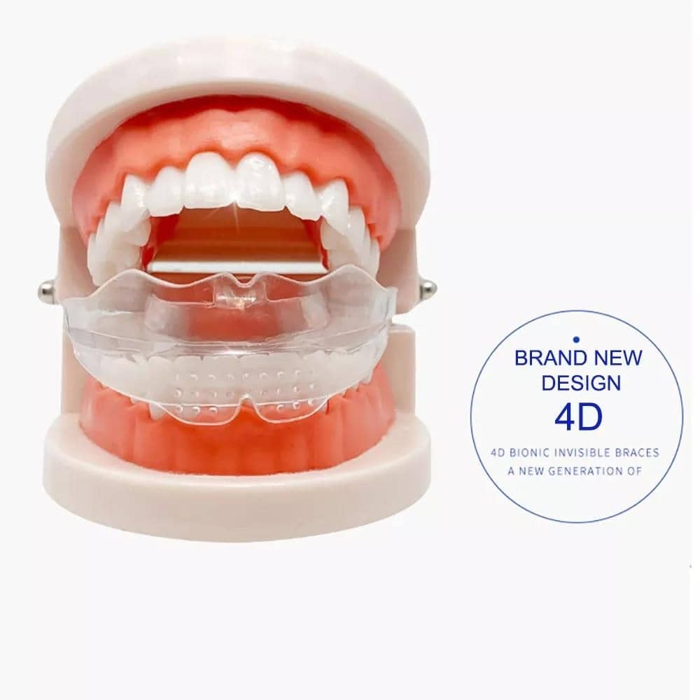 Ortodontiniai breketai Dantų breketai Smile dantų tiesinimo ...
